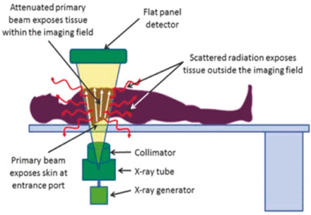 Radiation protection in the cardiac catheterisation lab: best practice ...