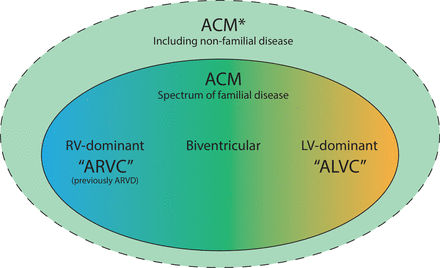 Arrhythmogenic right ventricular cardiomyopathy: a focused update on ...